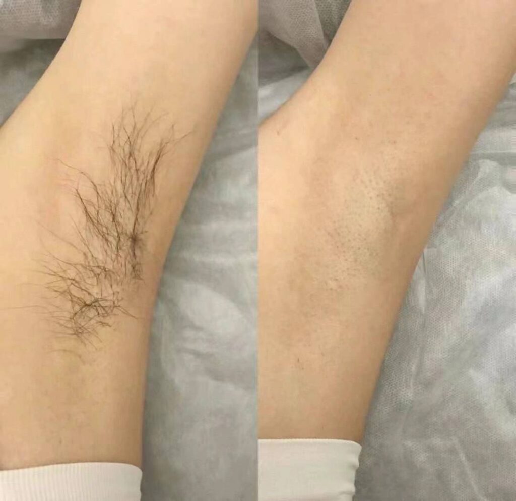 REBORN(リボーン) | 心、体、魂を解き放つエステサロン